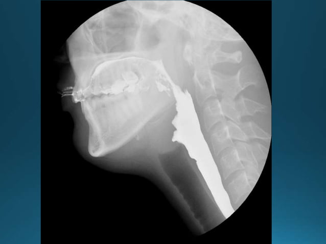 Basics of Barium Imaging | PPTX | Digestive Disorders | Diseases and ...