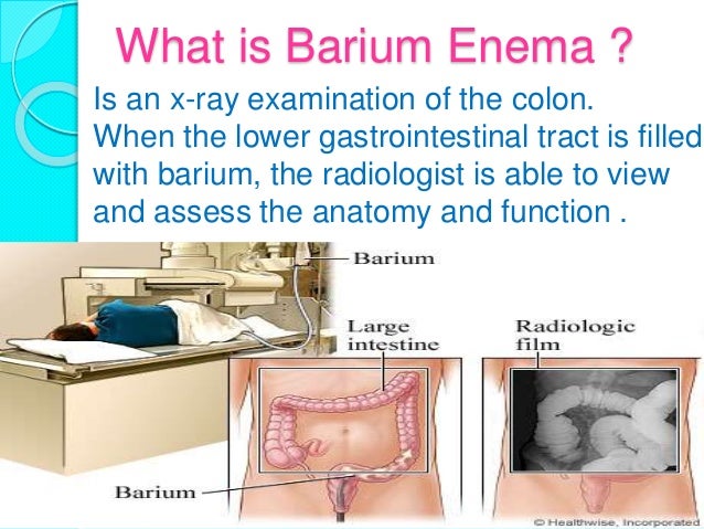 Barium enema