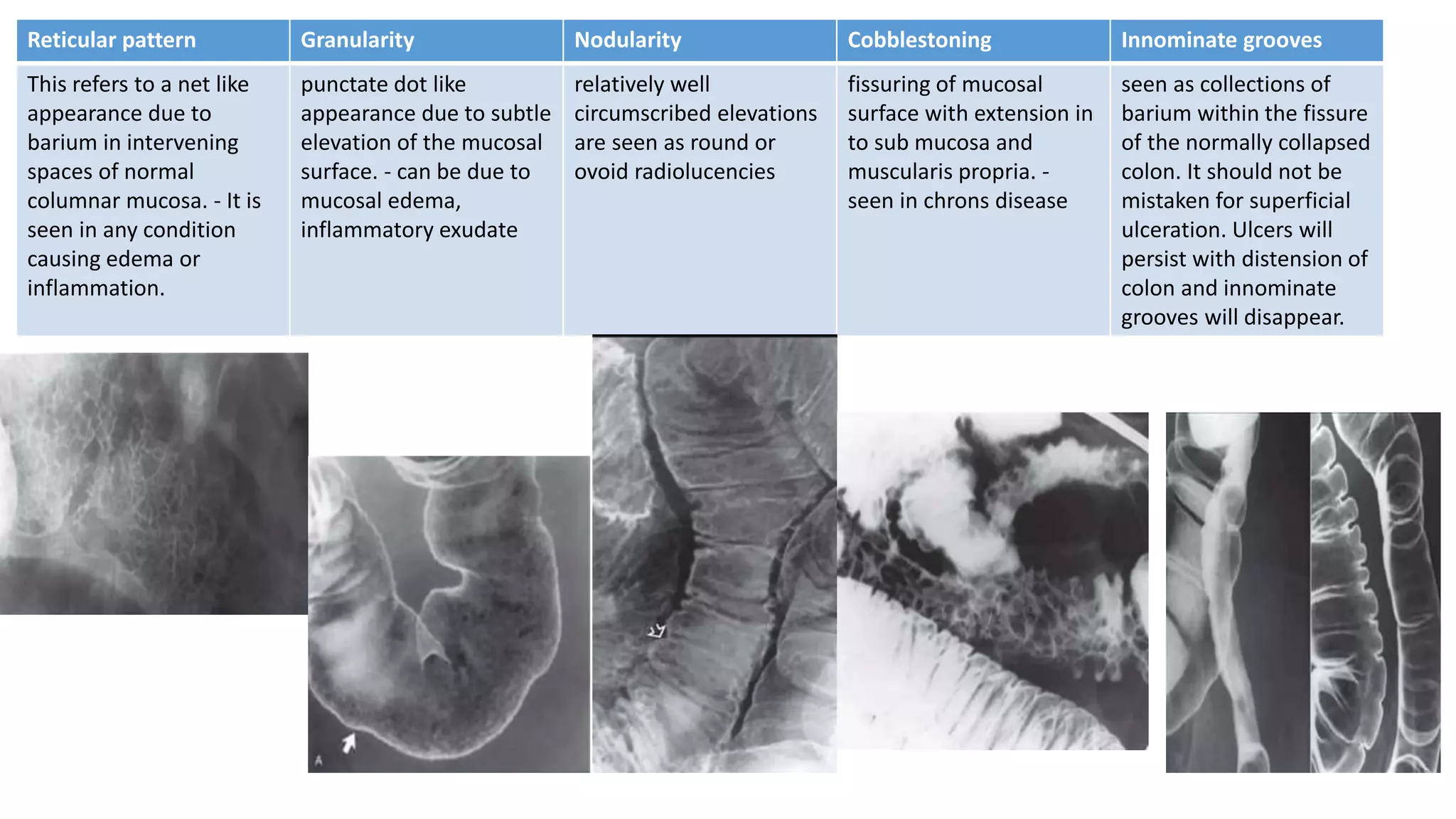 BARIUM ENEMA | PPTX