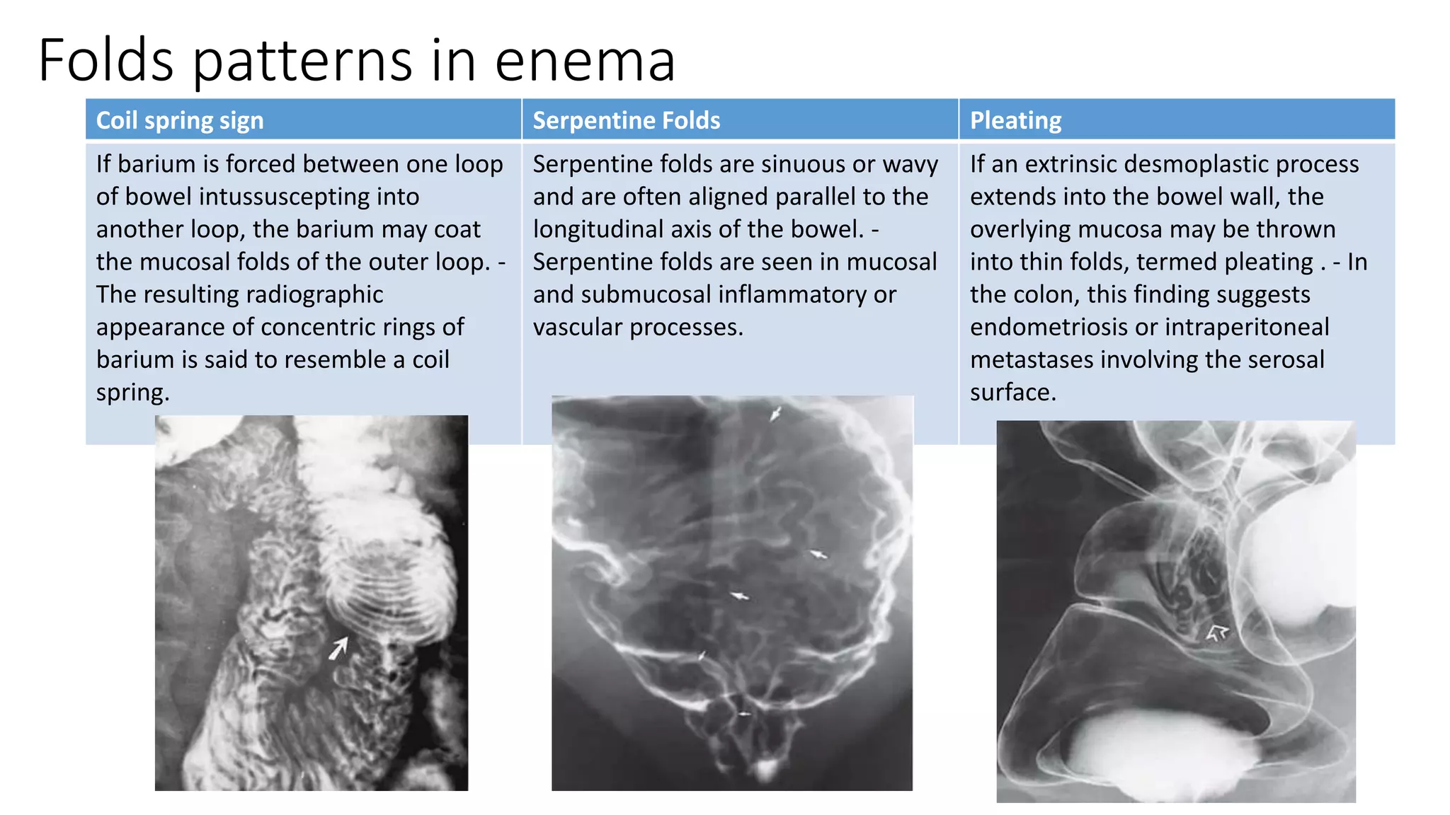 BARIUM ENEMA | PPTX