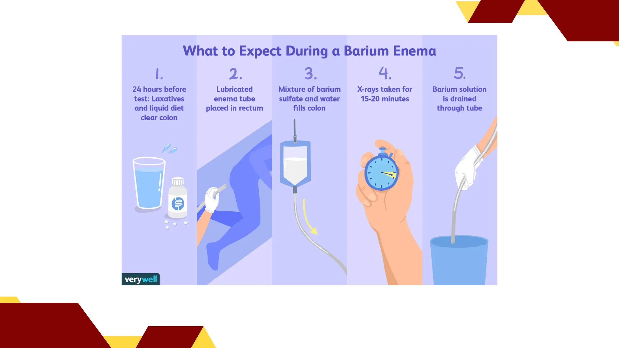 Barium Enema procedure in radiology department | PDF