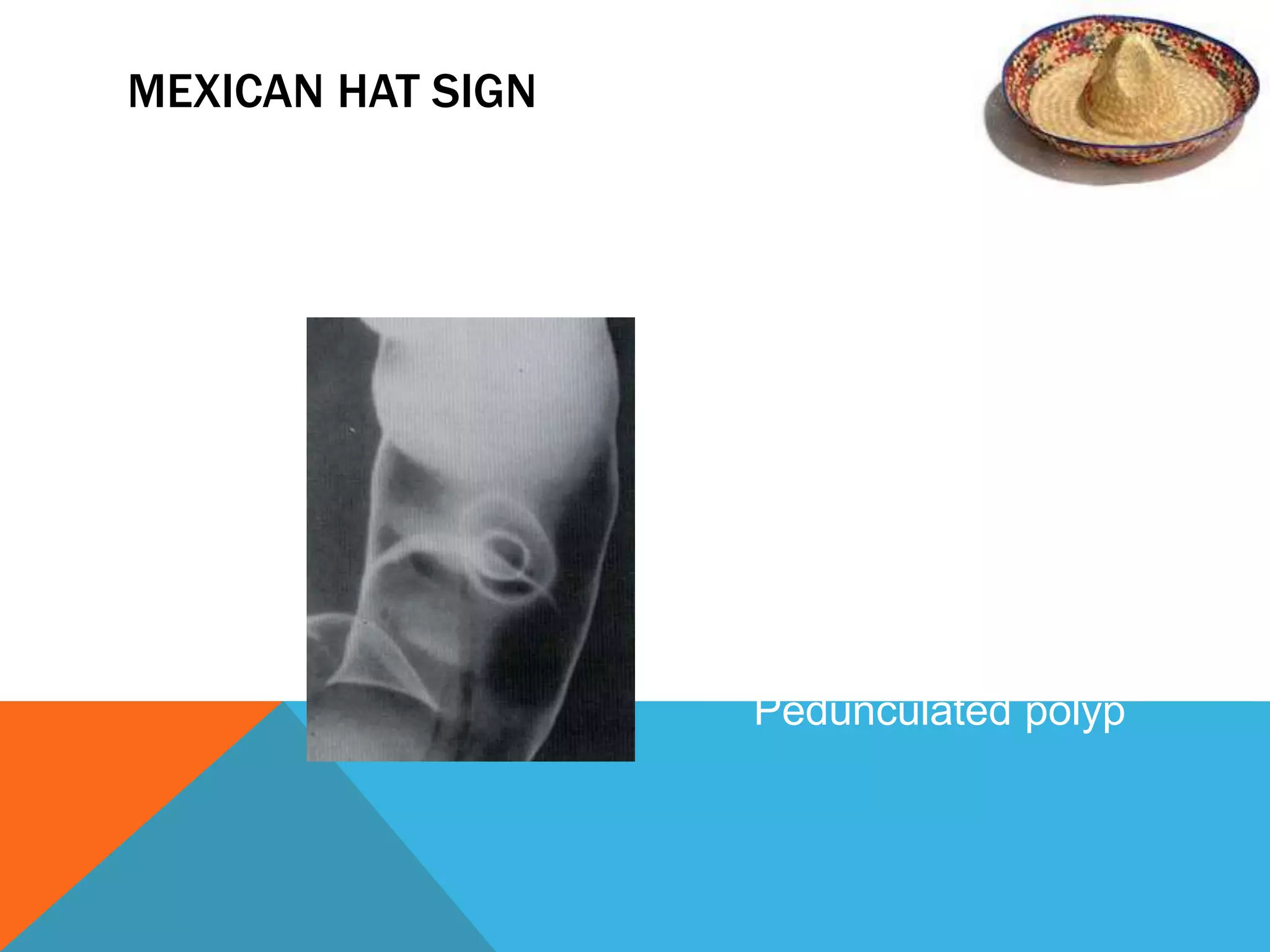 Barium enema ppt | PPTX