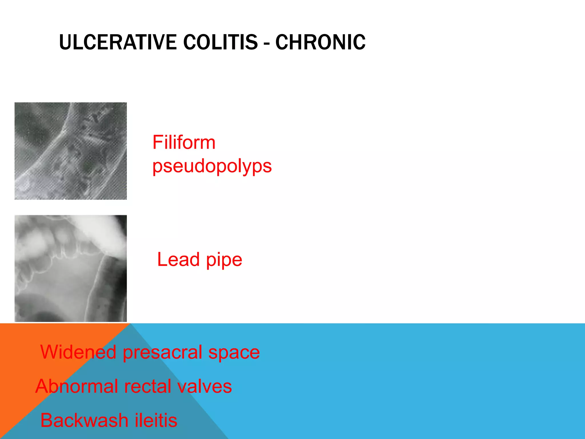 Barium enema ppt | PPTX