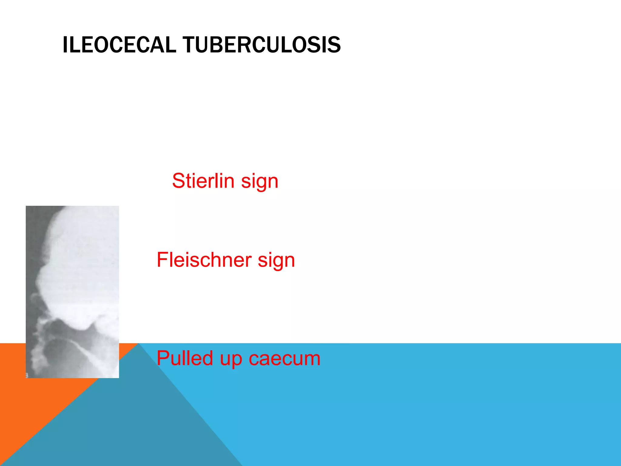 Barium enema ppt | PPTX | Digestive Disorders | Diseases and Conditions