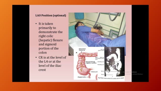 Barium enema by debajyoti | PPTX | Digestive Disorders | Diseases and Conditions
