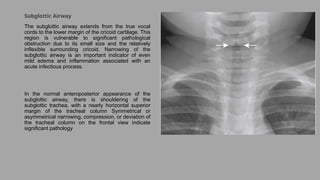 Larynx and barium follow through radiology.pptx