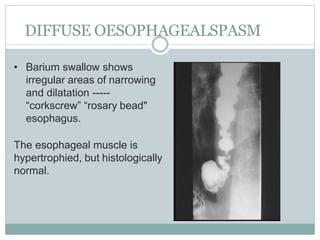 Barium Lecture.pptx
