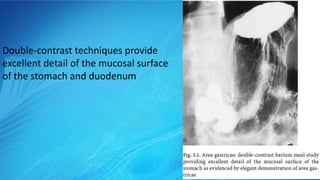 Barium Meal | PPTX