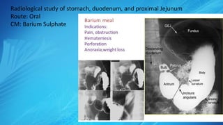 Barium Meal | PPTX