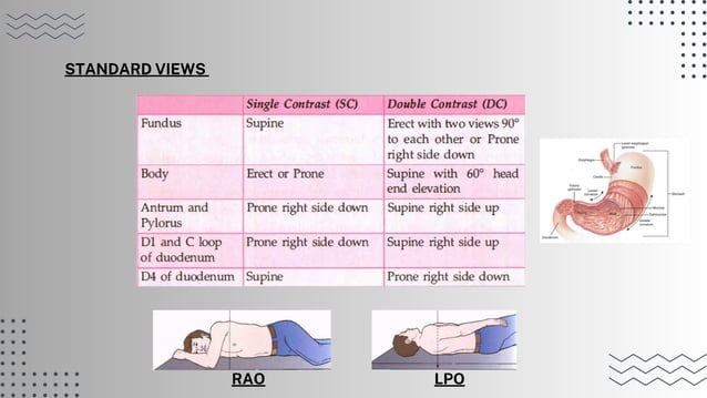 Barium Meal procedure in radiology department | PDF | Digestive ...