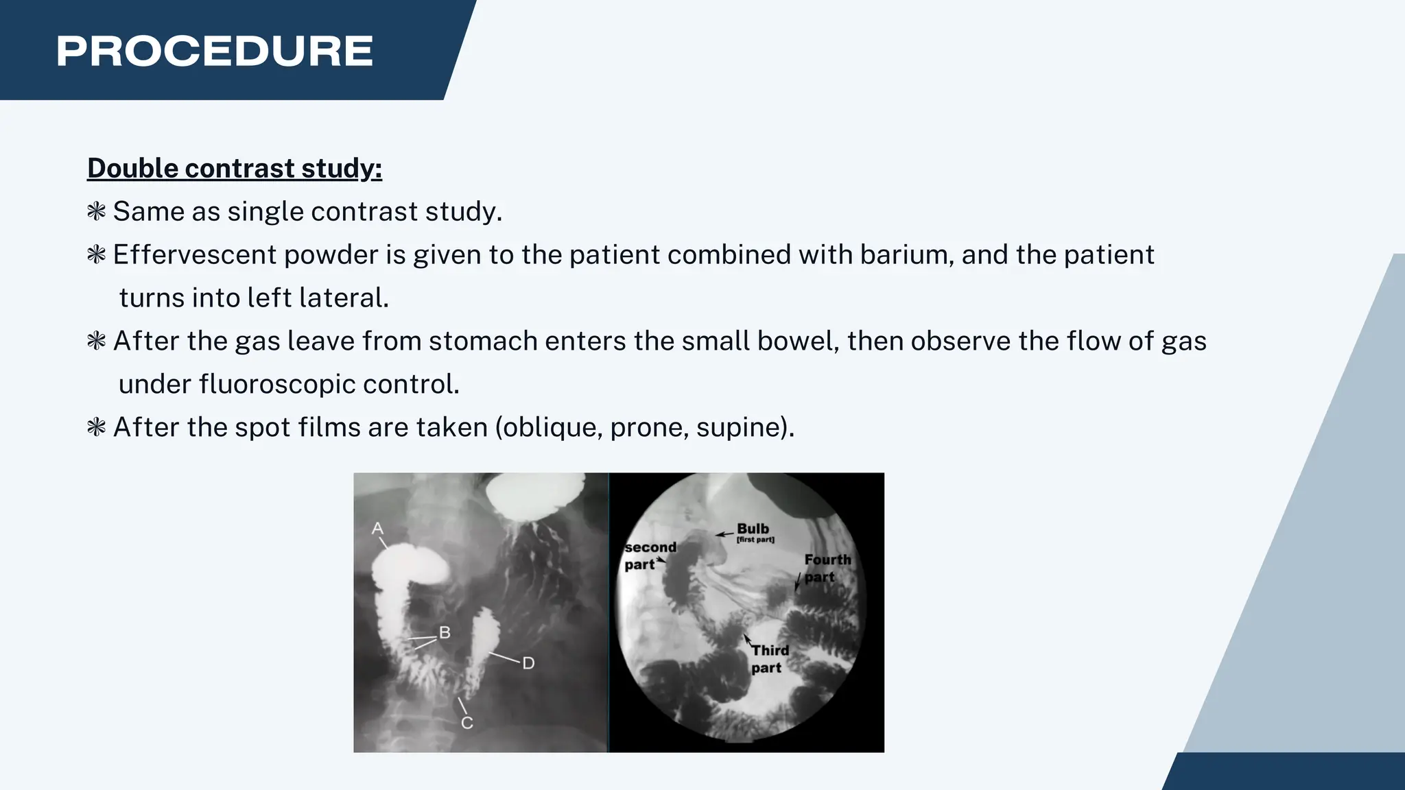Barium meal follow through procedure in radiology department | PDF