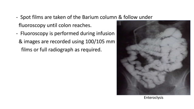 Barium meal follow through (BMFT), Enteroclysis and Barium enema (BE ...
