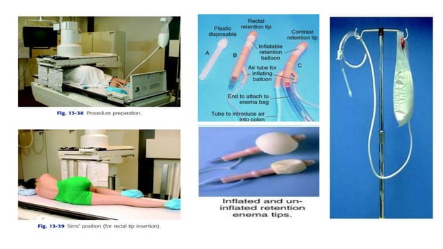 Barium meal follow through (BMFT), Enteroclysis and Barium enema (BE ...