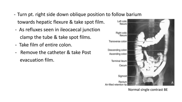 Barium meal follow through (BMFT), Enteroclysis and Barium enema (BE ...