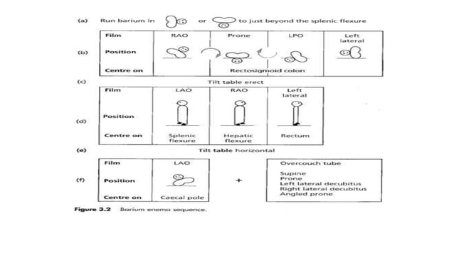 Barium meal follow through (BMFT), Enteroclysis and Barium enema (BE ...