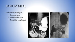 Barium meal PPT Slide PK | PPT