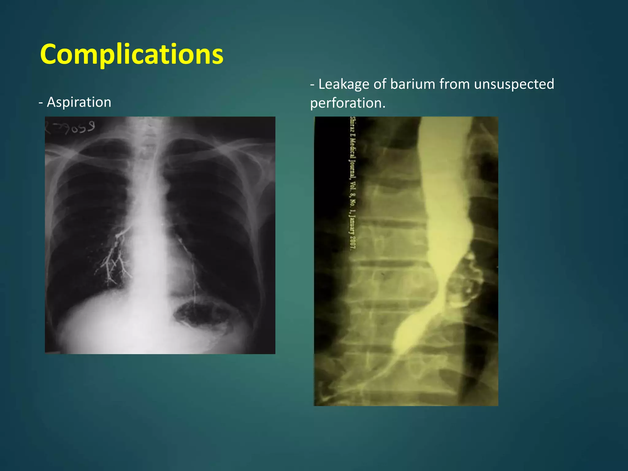 Barium procedures | PPTX