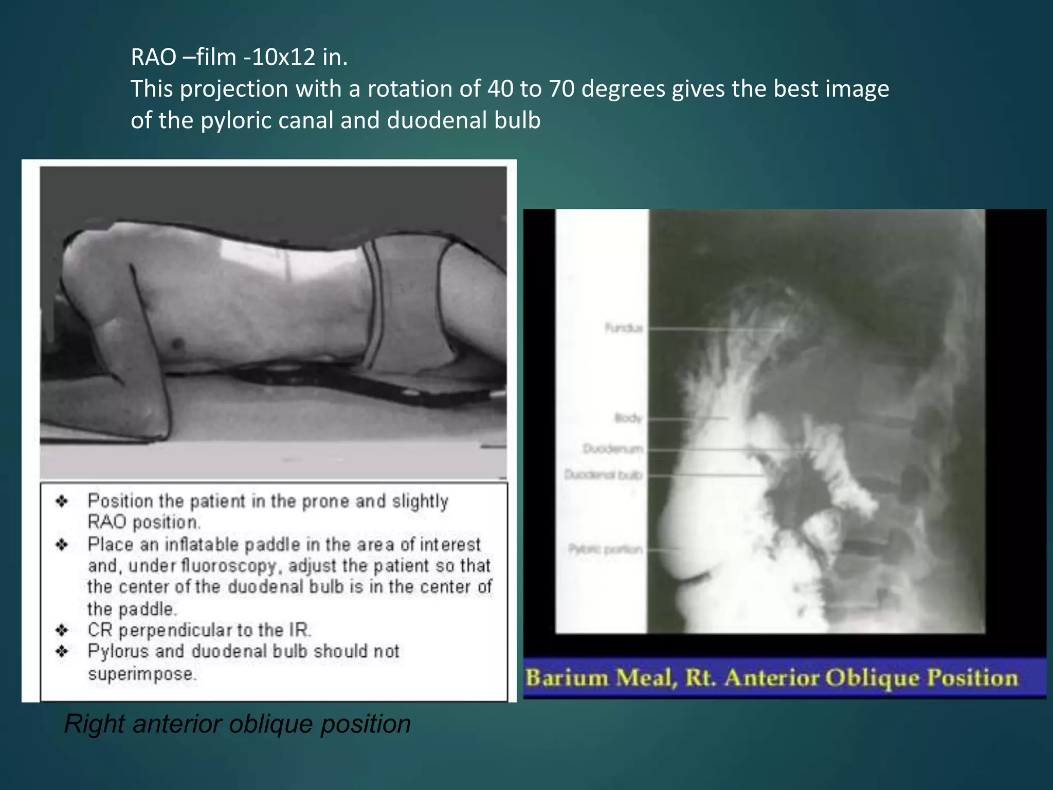 Barium procedures | PPTX