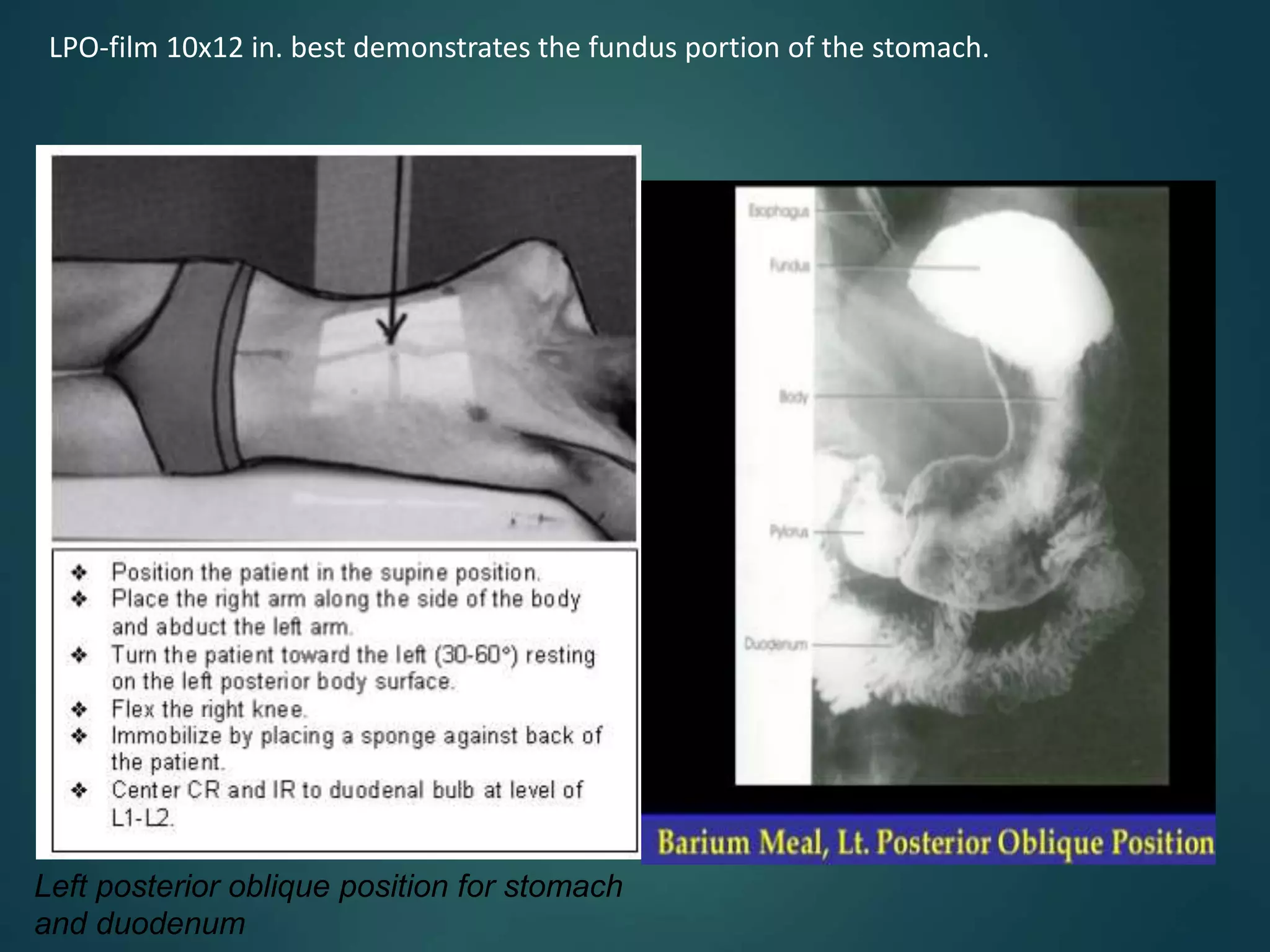 Barium procedures | PPTX