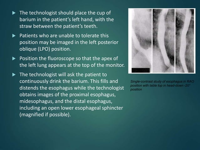 Barium procedures | PPTX | Digestive Disorders | Diseases and Conditions