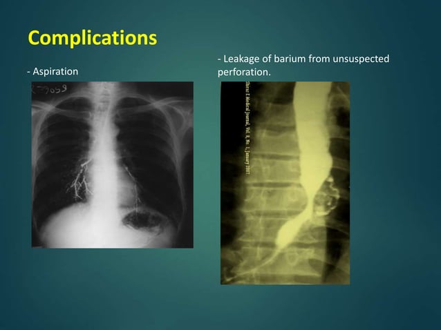 Barium procedures | PPTX | Digestive Disorders | Diseases and Conditions