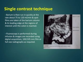 Barium procedures | PPTX