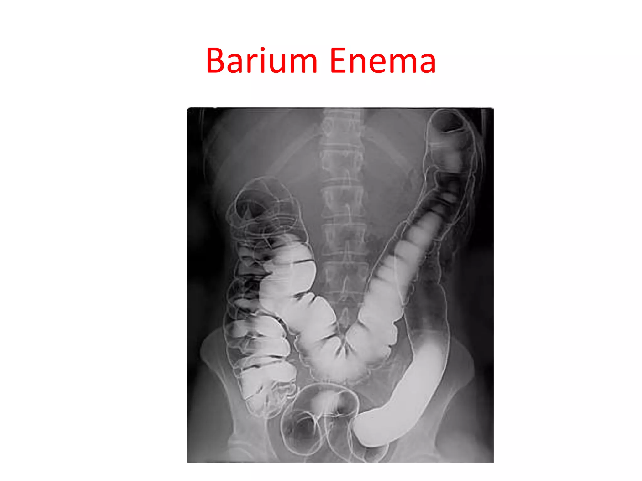 Barium studies | PPTX