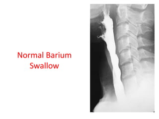 Barium studies | PPTX