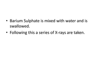 Barium studies | PPTX