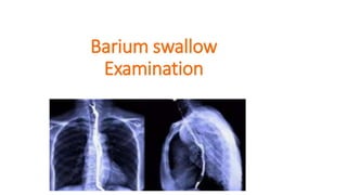 Barium studies and the nursing responsibilities | PPTX