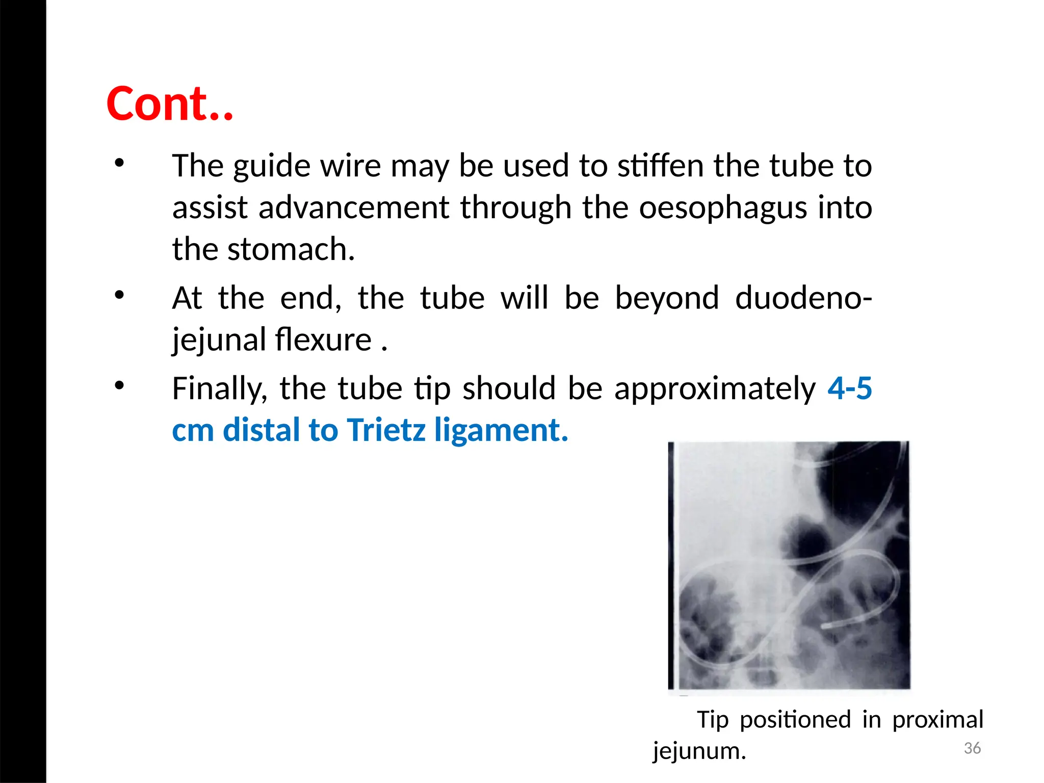 Barium Studies of lower GI Tract by joginder.pptx