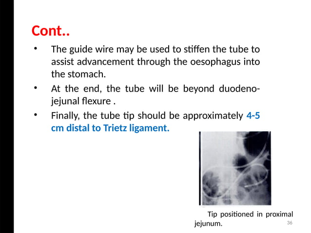 Barium Studies of lower GI Tract by joginder.pptx