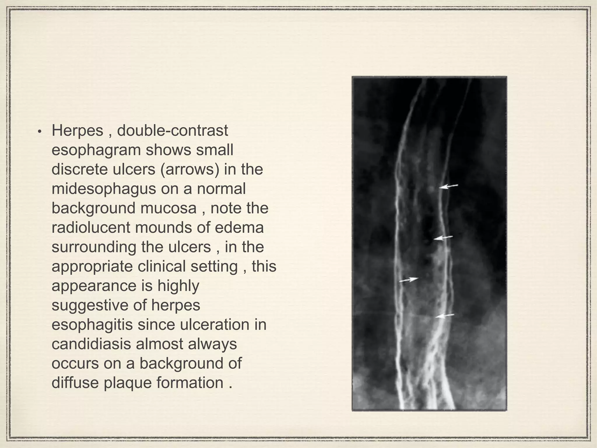 Barium swallow,, | PPTX