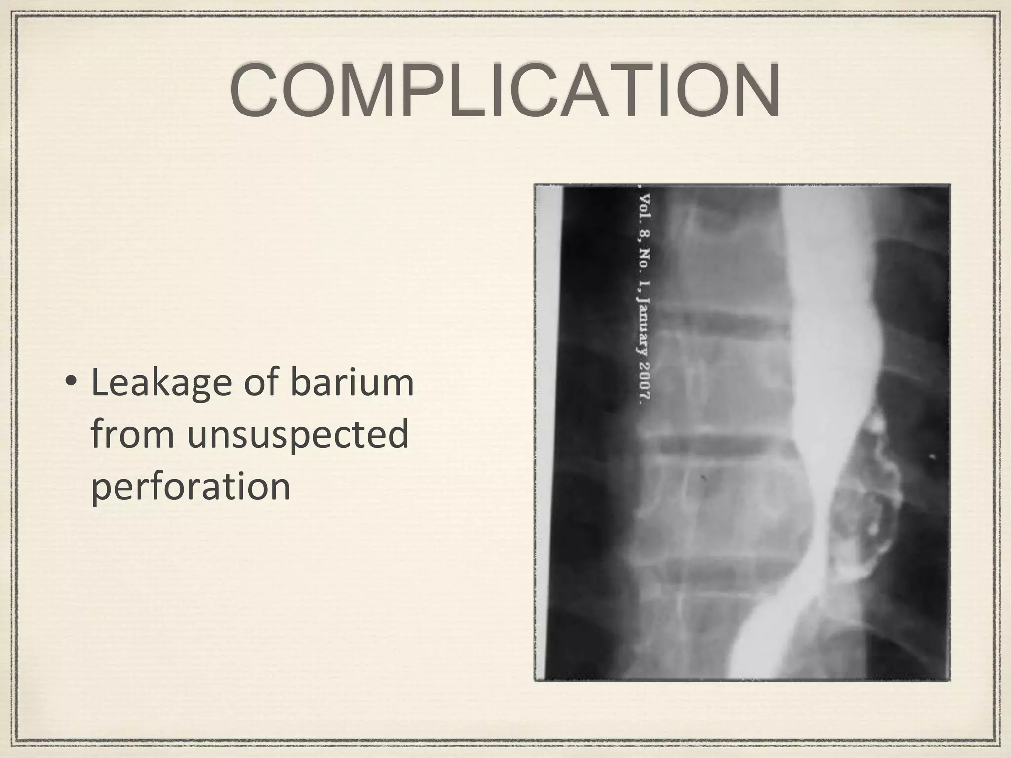 Barium swallow,, | PPTX