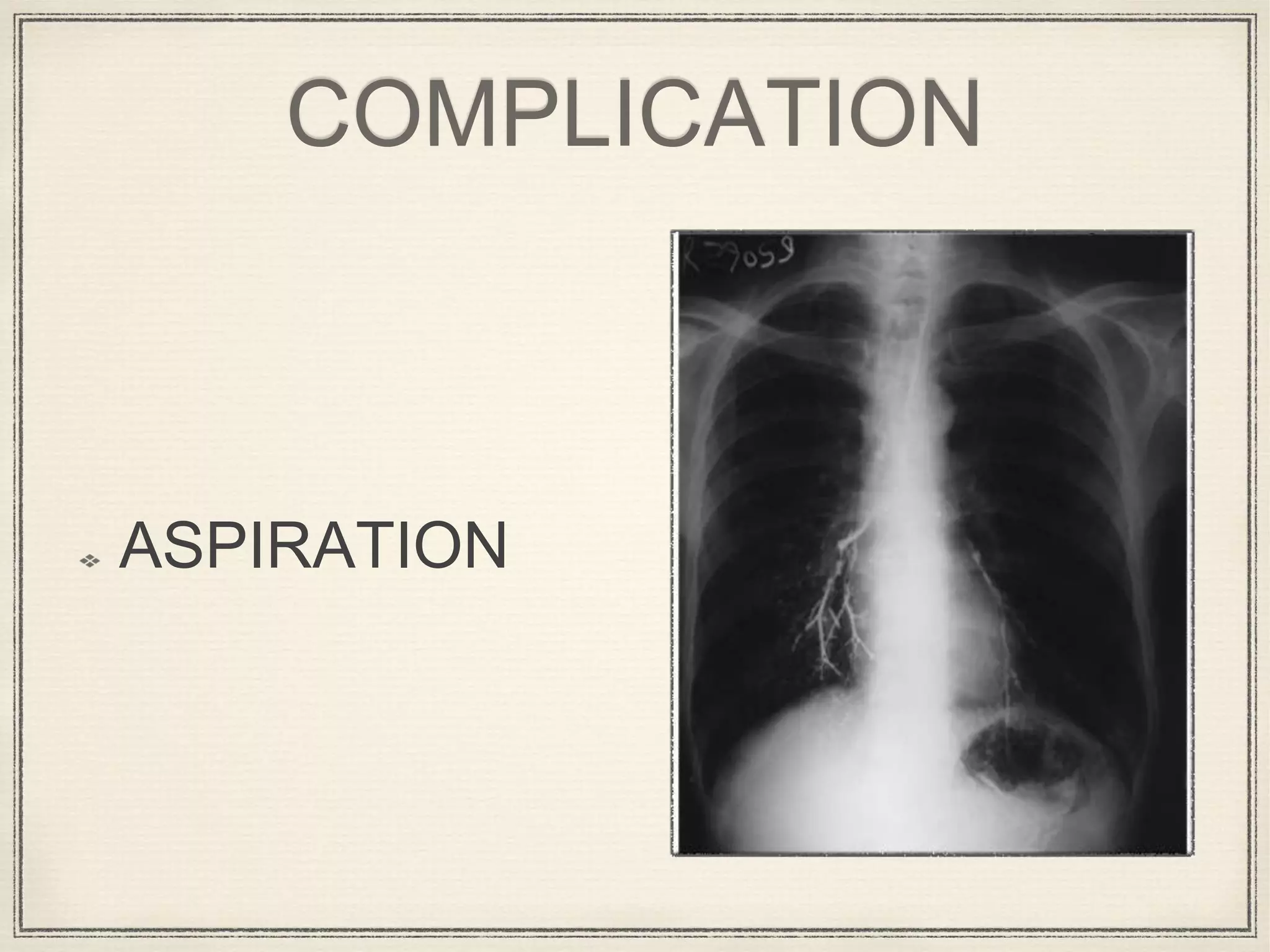 Barium swallow,, | PPTX