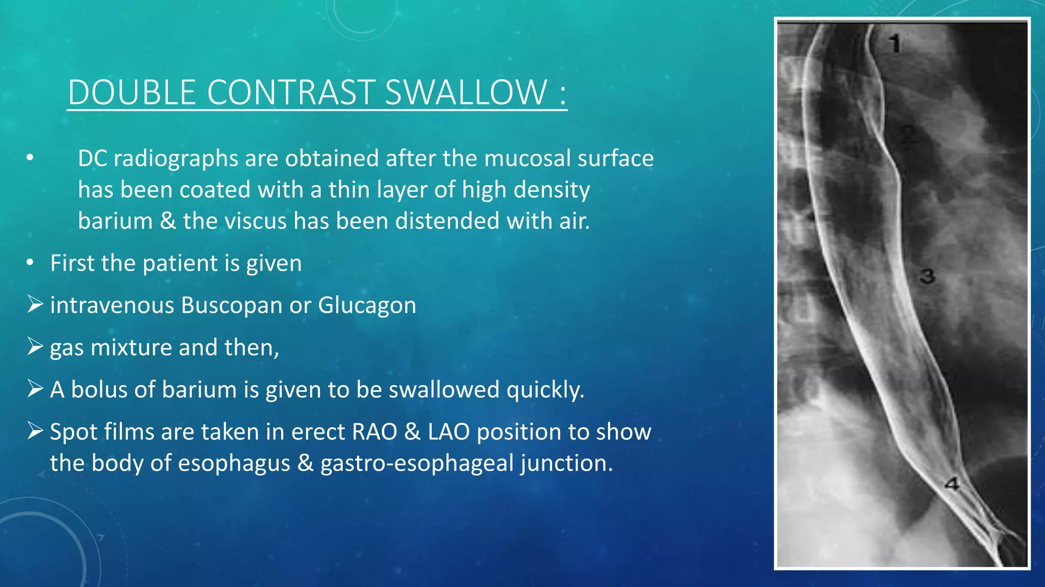 Barium swallow | PPTX