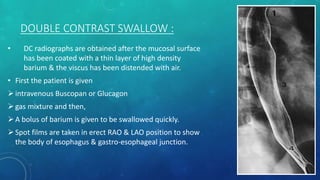 Barium swallow | PPTX