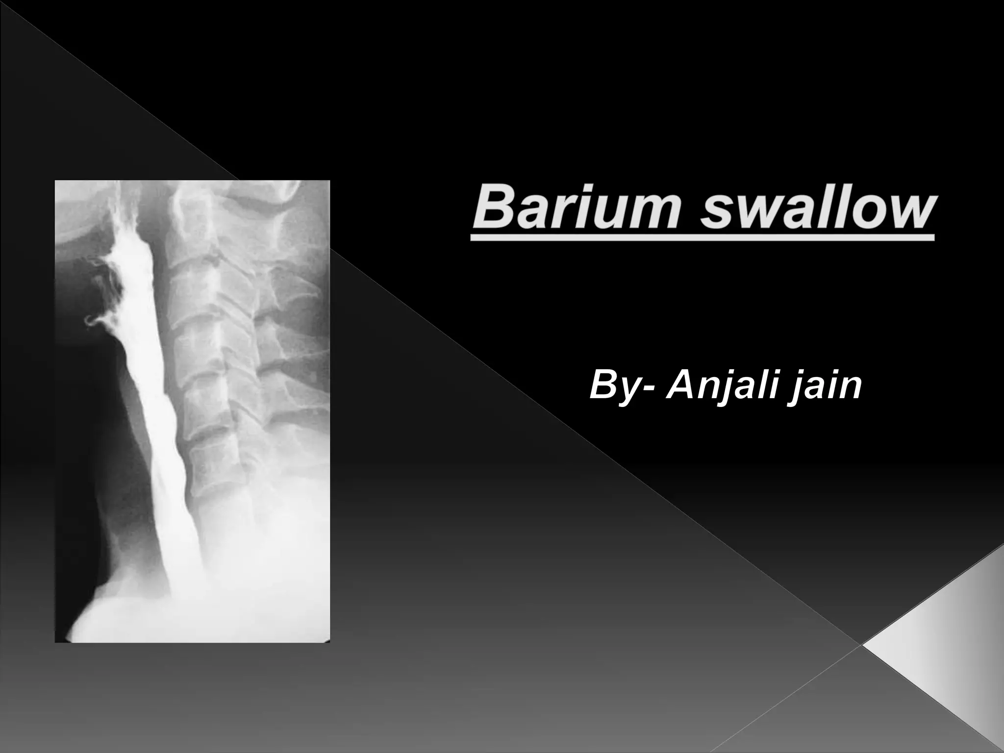 Barium swallow | PPTX