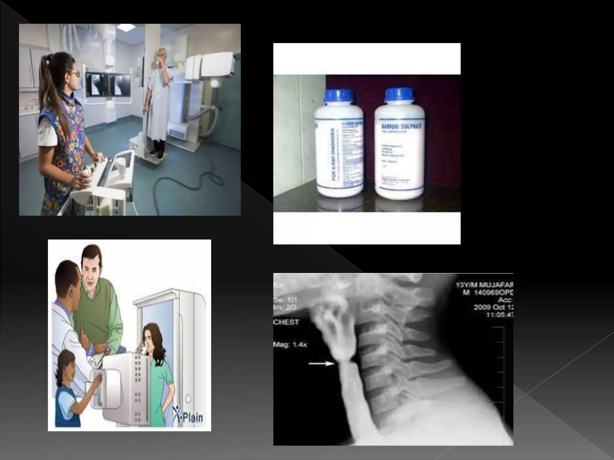 Barium swallow | PPTX