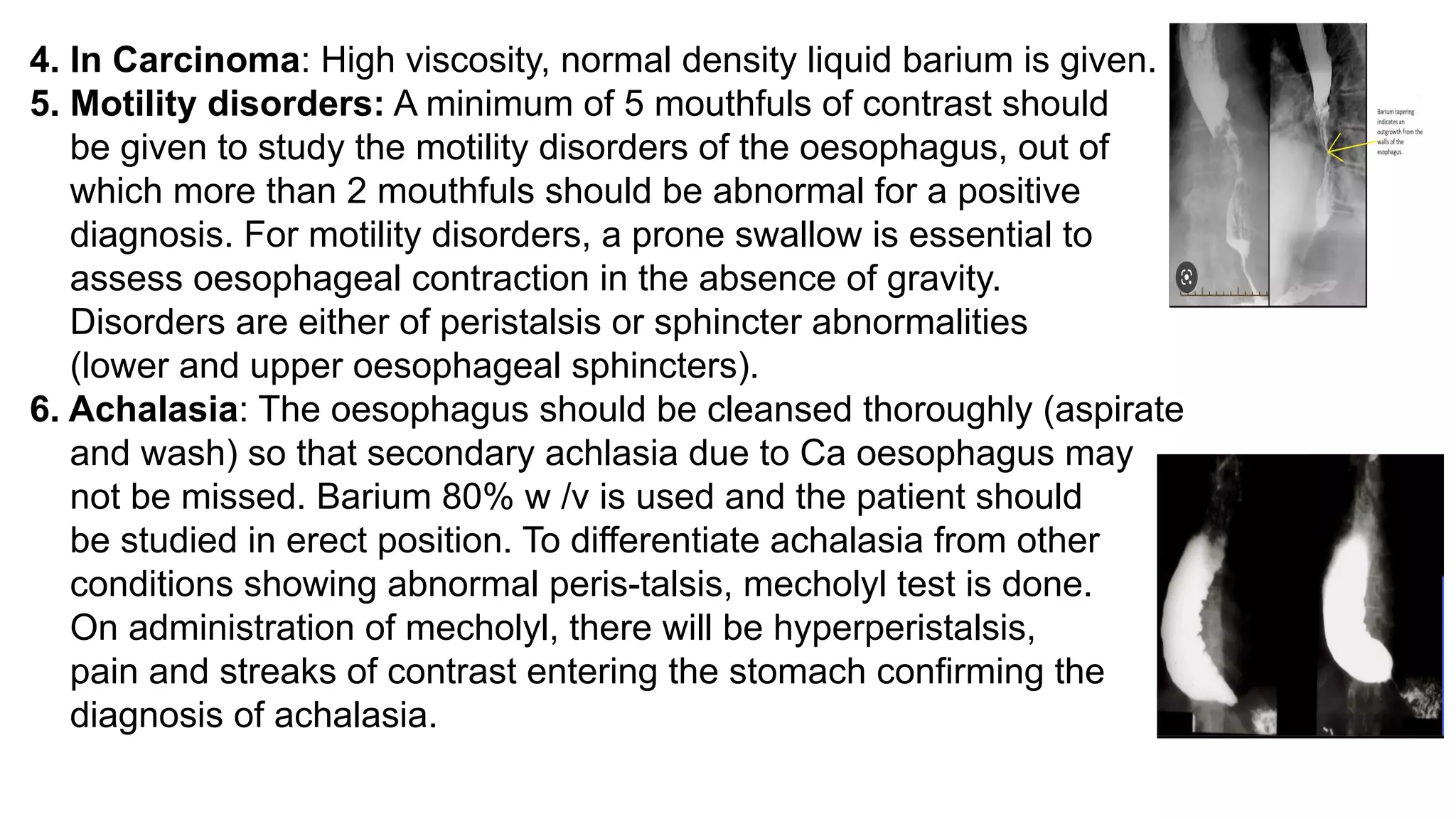 Barium swallow .pdf