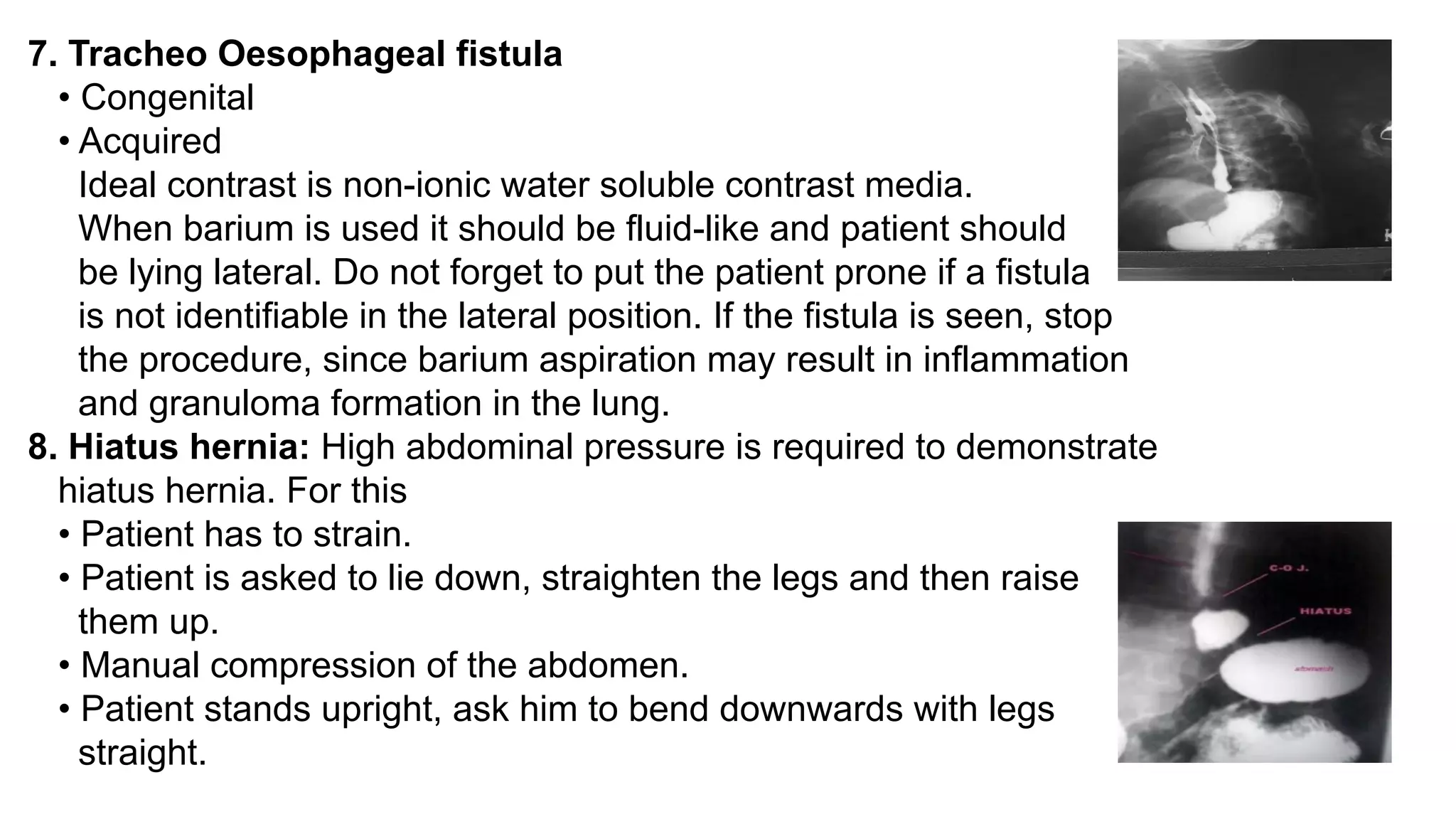 Barium swallow .pdf
