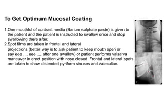 Barium swallow .pdf