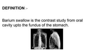 Barium swallow .pdf