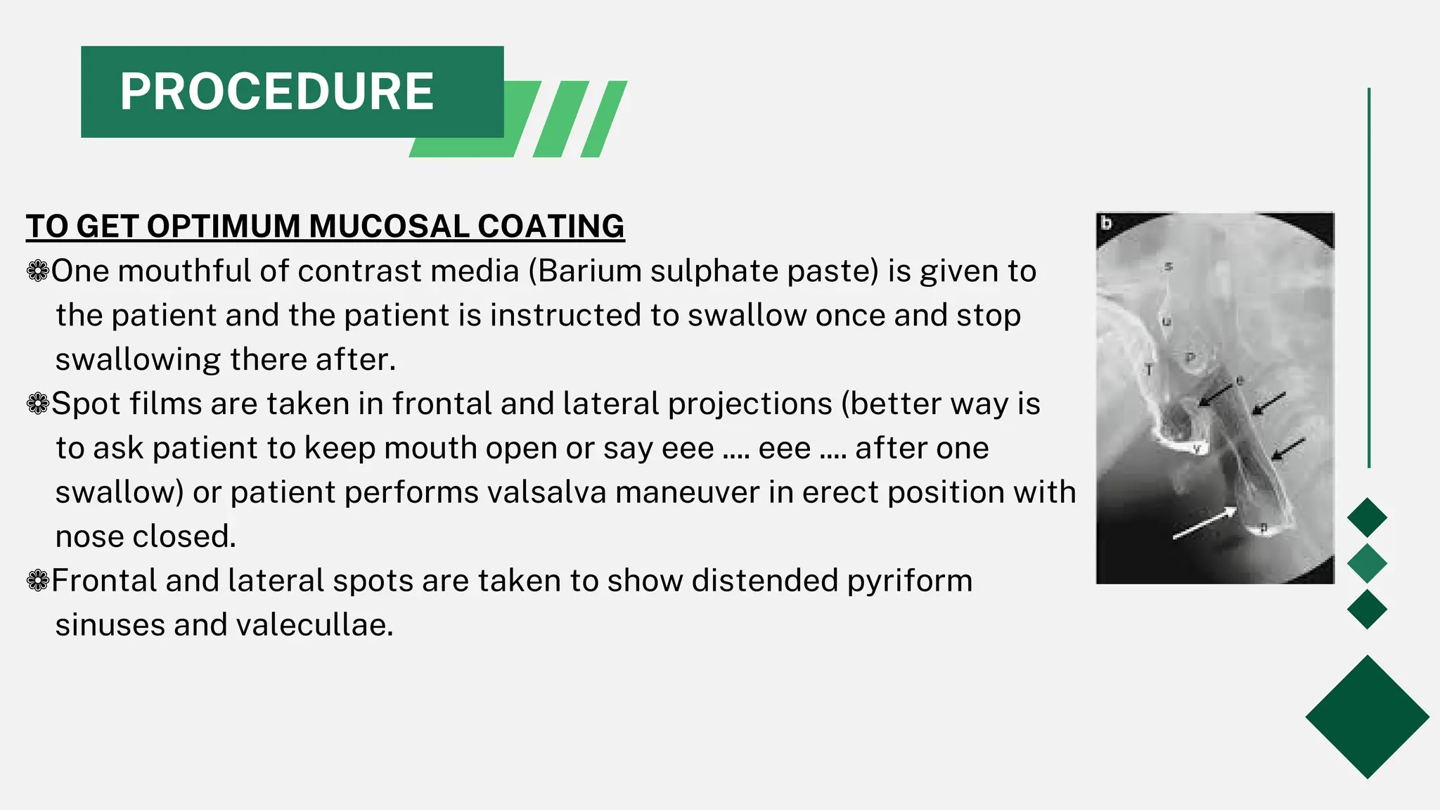 Barium Swallow procedure in radiology department | PDF