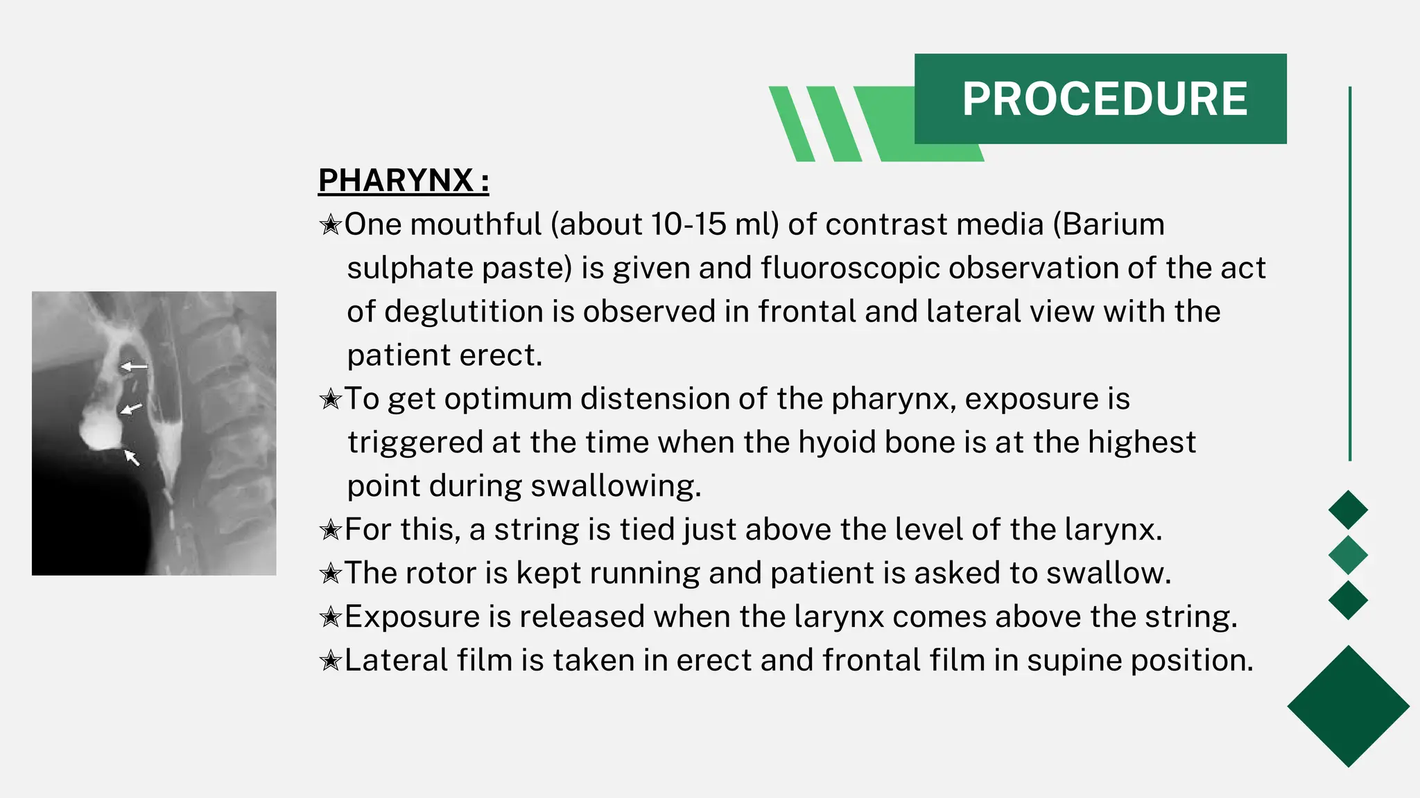Barium Swallow procedure in radiology department | PDF