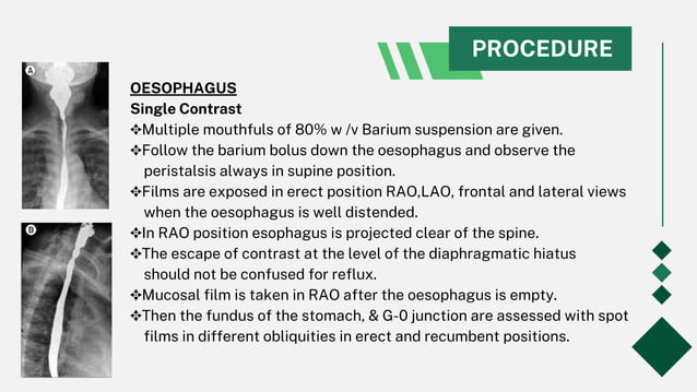 Barium Swallow procedure in radiology department | PDF | Digestive ...
