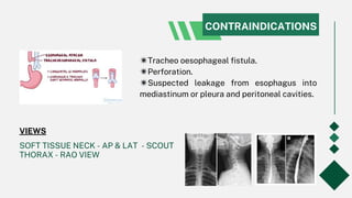 Barium Swallow procedure in radiology department | PDF