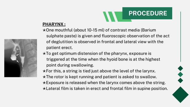 Barium Swallow procedure in radiology department | PDF | Digestive ...