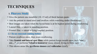 Barium Swallow Radiographic Procedure.pptx