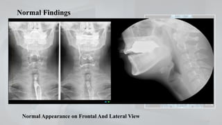 Barium Swallow Radiographic Procedure.pptx